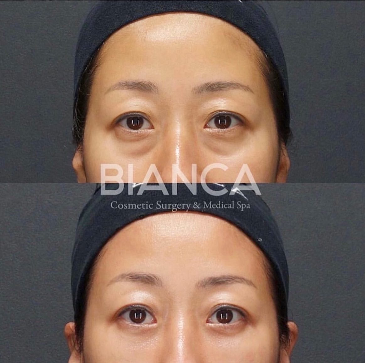 目元 日本を代表する美容健康再生医療のクリニック｜biancaginza